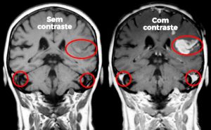 As perguntas mais frequentes sobre uso de contraste em exames de imagem